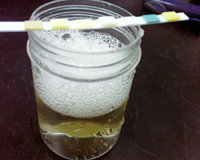 Protéinurie: Protéines Dans Les Urines | Protéines